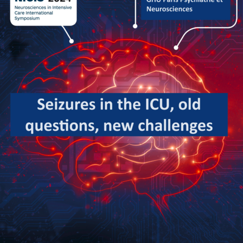 Potentiels Évoqués Visuels (PEV) - SNCLF - Société de Neurophysiologie ...